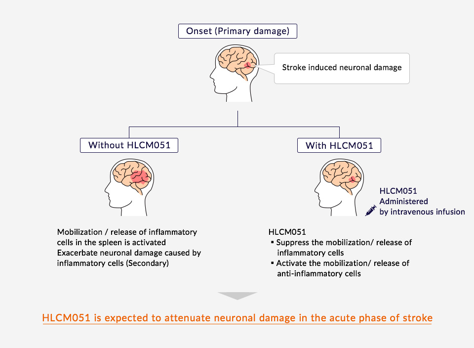 Ischemic Stroke Healios K K 